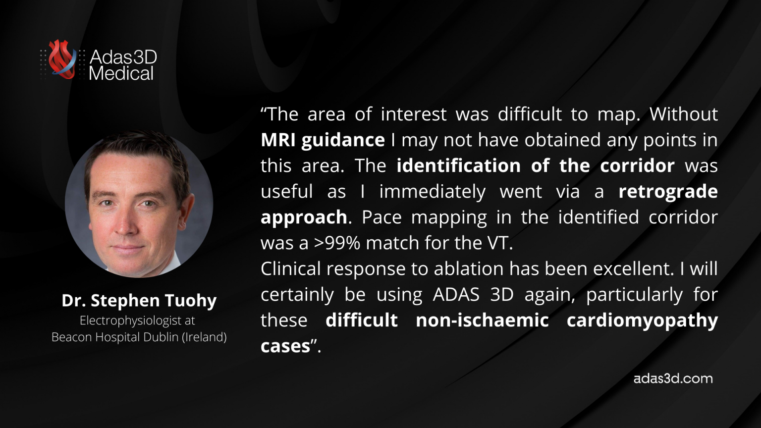 Challenging case of recurrent Ventricular Tachycardia - Adas 3D